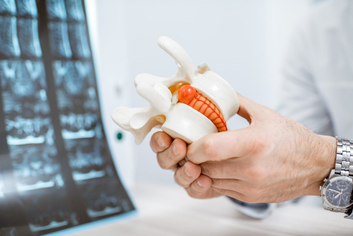 5 Things to Know About a Lumbar Microdiscectomy - Howell Allen Clinic
